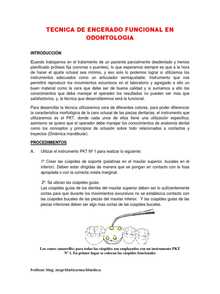 Tecnica de Encerado Funcional en Odontologia | PDF | Dentadura postiza | Salud y bienestar