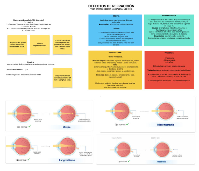 Defectos de Refracción | PDF | Ojo humano | Lentes