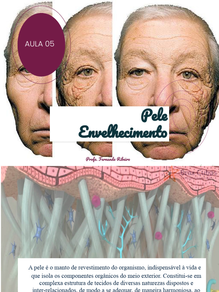 Aula 5 Dermato - Pele - Envelhecimento | Download grátis PDF | Pele ...