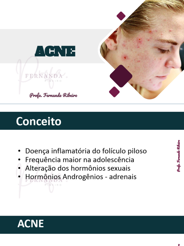 Aula 07 e 08 Dermatologia - Acne (1)_watermark | PDF | Inflamação ...