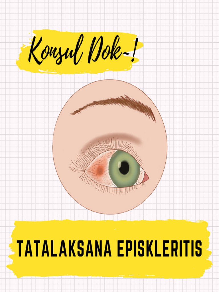 Tatalaksana Episkleritis-1 | PDF