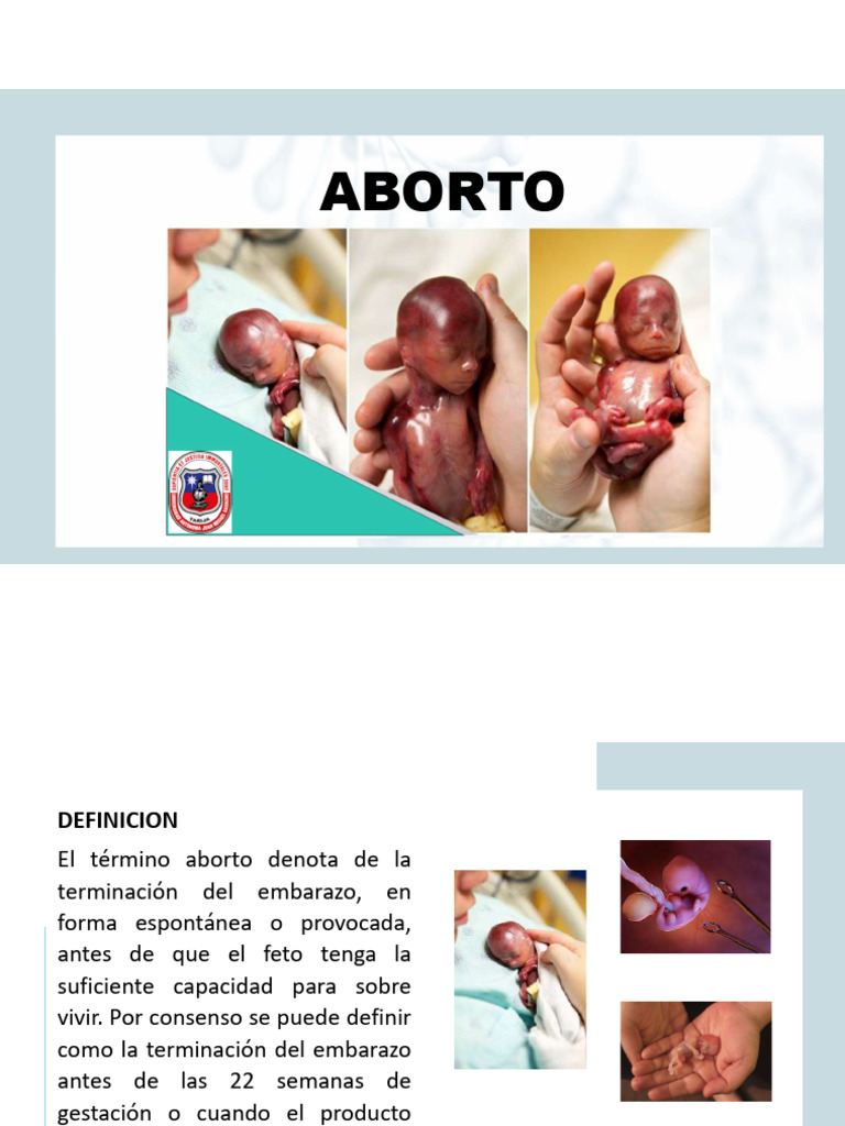 ABORTO | PDF | El embarazo | Aborto espontáneo