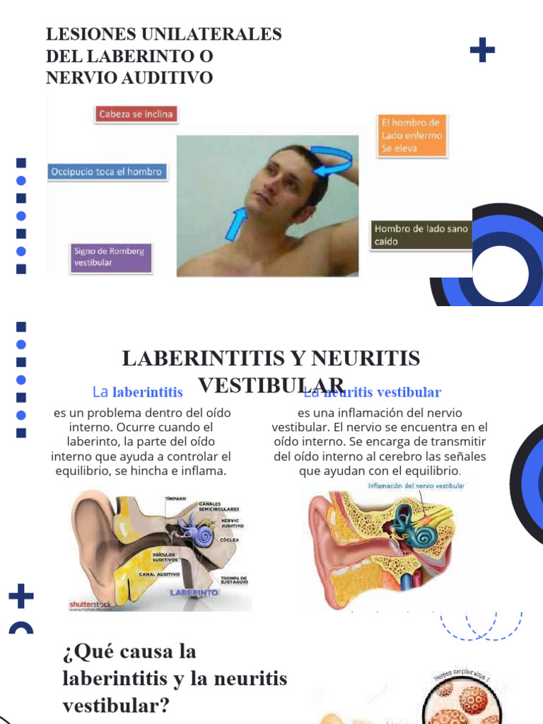 Lesiones Unilaterales Del Laberinto o Nervio Auditivo | PDF