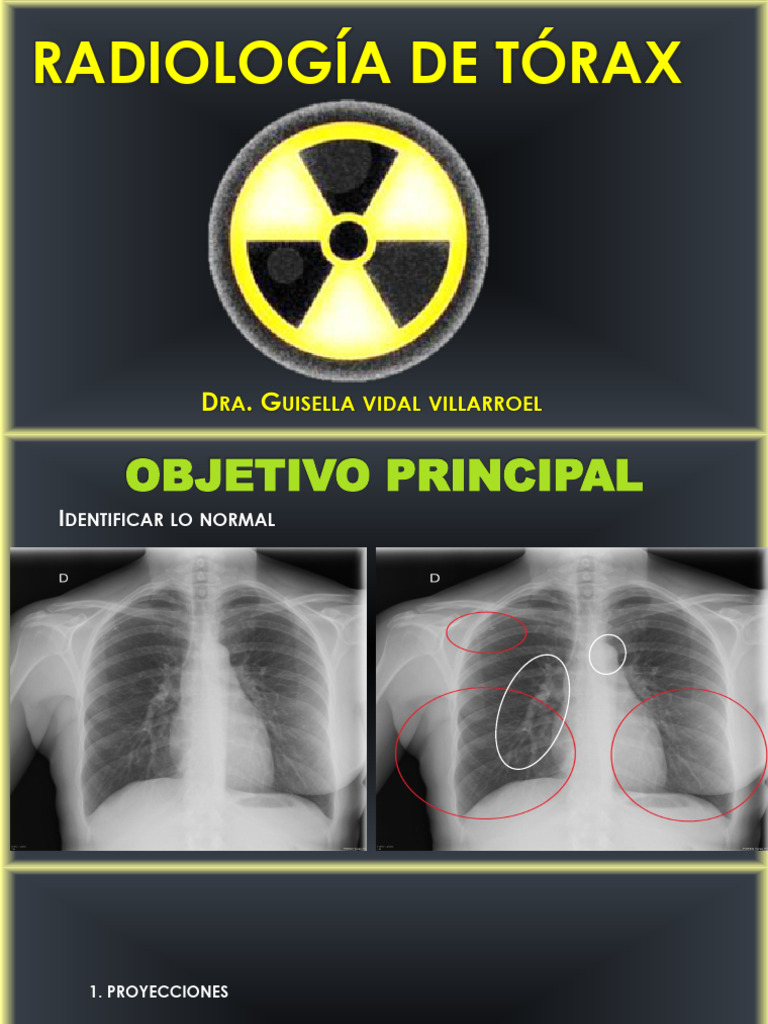 RX de Torax | PDF | Pulmón | Tórax