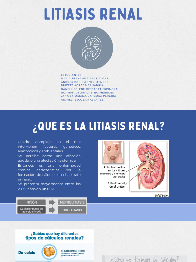 Litiasis Renal | PDF | Especialidades Medicas | Medicina CLINICA