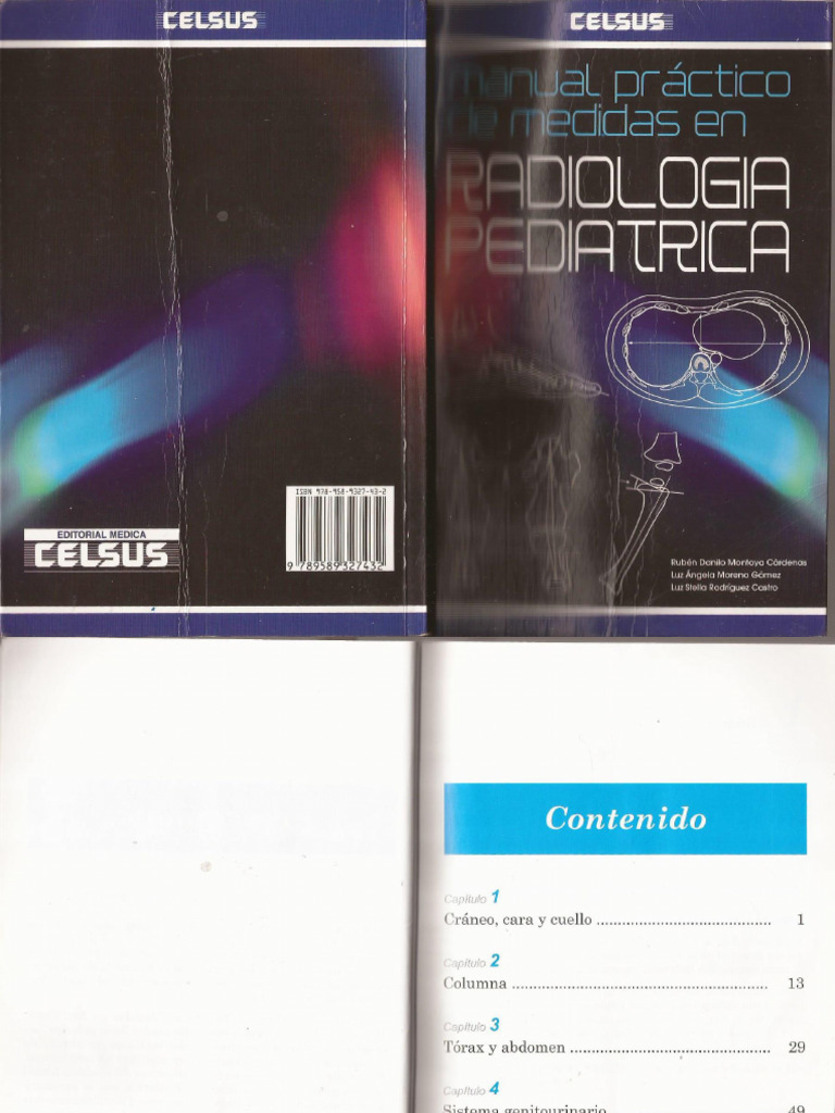 Manual Practico de Medidas en Radiologia Pediatrica | PDF