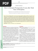 Rosenberg Knee X-Ray Positioning Guide | PDF | Radiology | X Ray