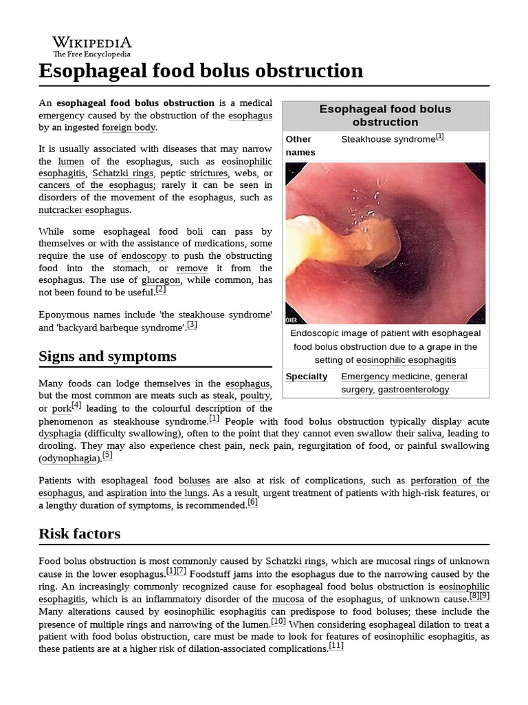 Esophageal Food Bolus Obstruction | PDF | Gastroenterology | Medicine
