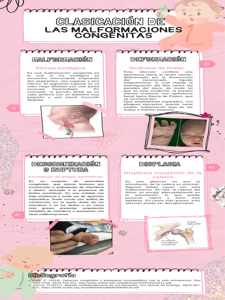 Malformación infografia | PDF | Enfermedades y trastornos humanos ...