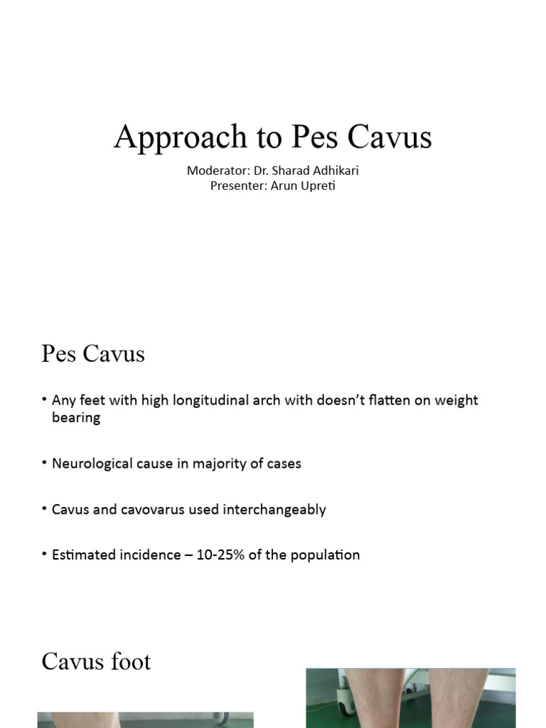 Approach to Pes Cavus | PDF | Foot | Ankle