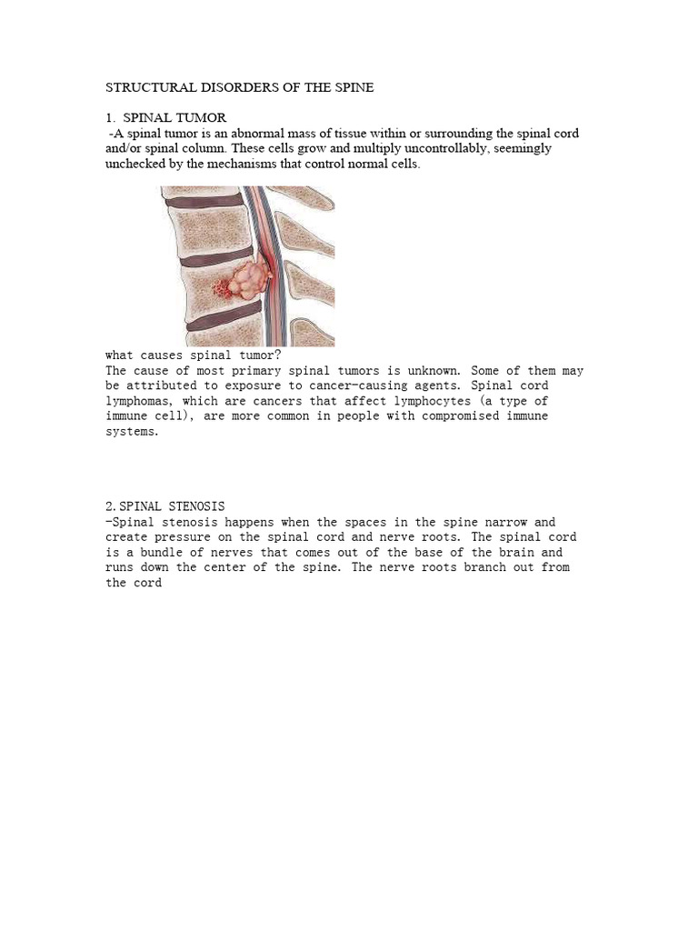 Structural Disorders of The Spine | PDF | Vertebral Column | Spinal Cord