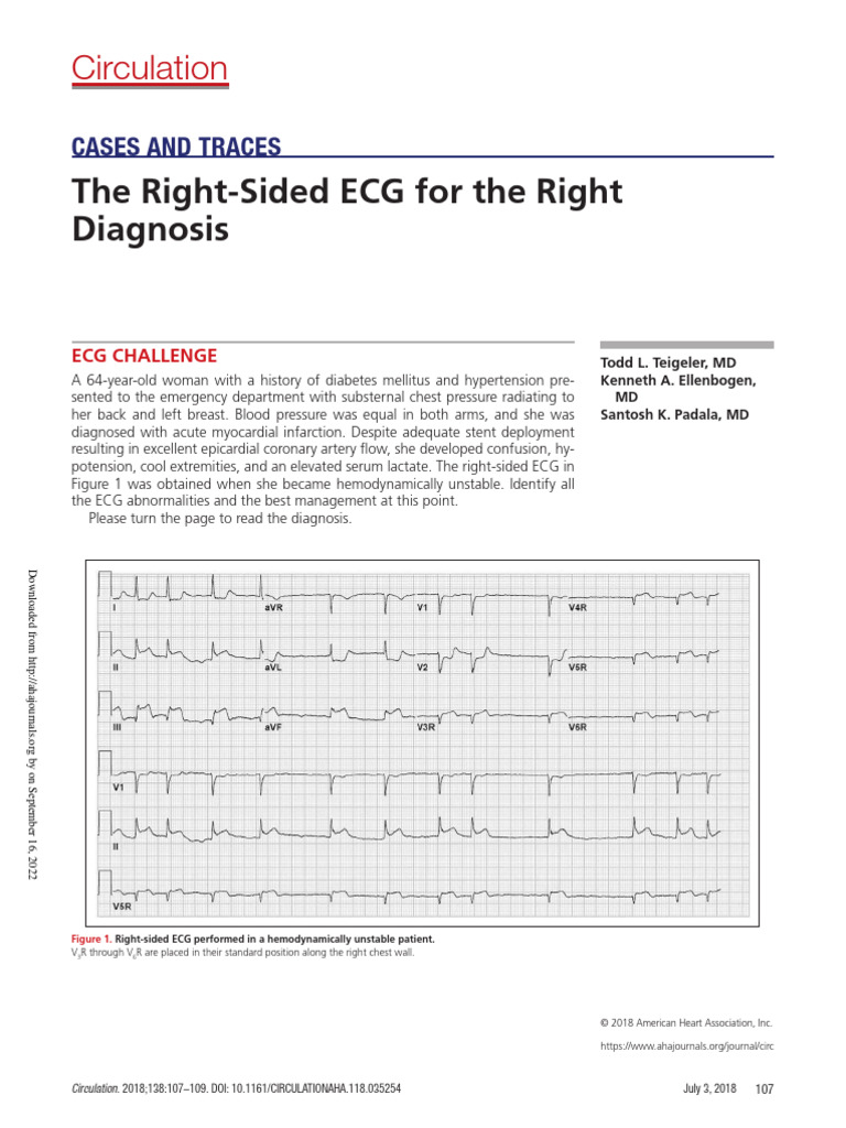 2018.the Right-Sided ECG For The Right Diagnosis | PDF | Myocardial ...