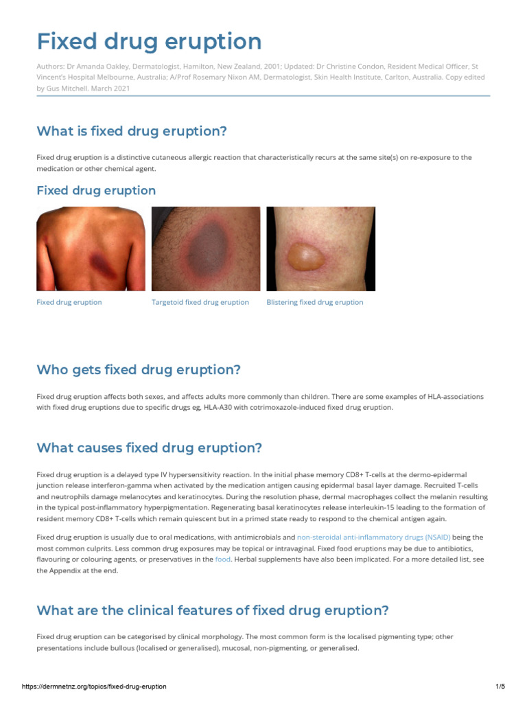 Fixed Drug Eruption - DermNet | PDF | Medical Specialties | Diseases ...