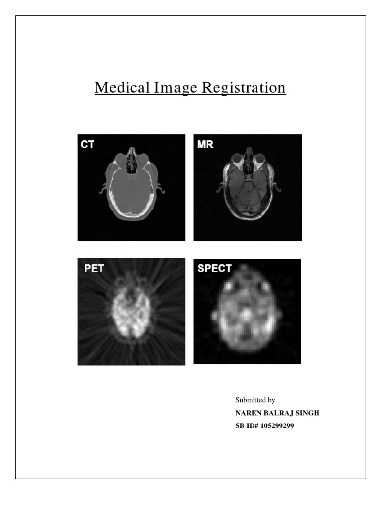 Medical Image Registration Techniques | PDF | Medical Imaging ...