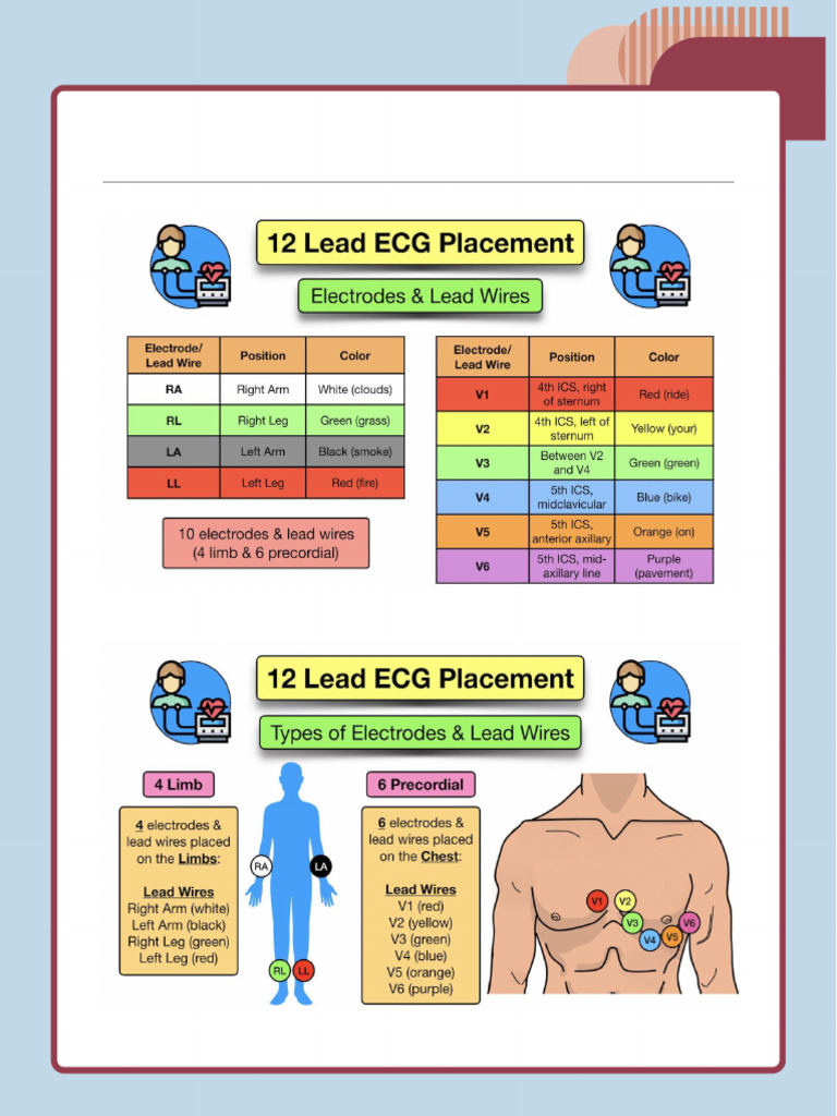 ECG Placement | PDF