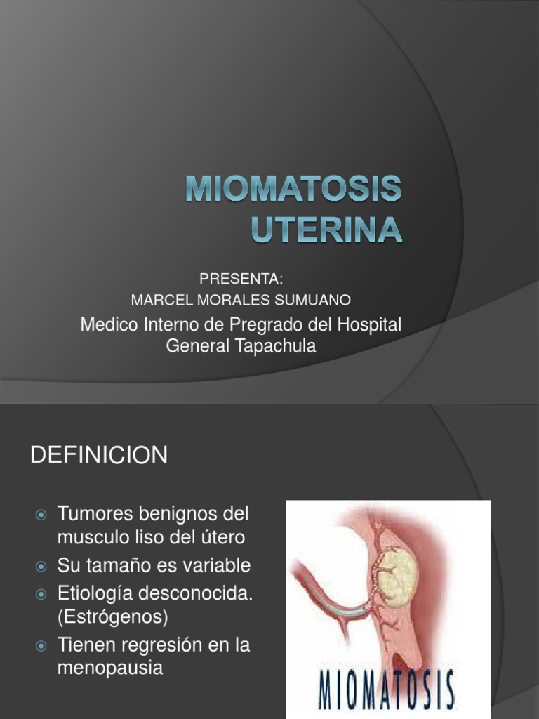 MIOMATOSIS UTERINA