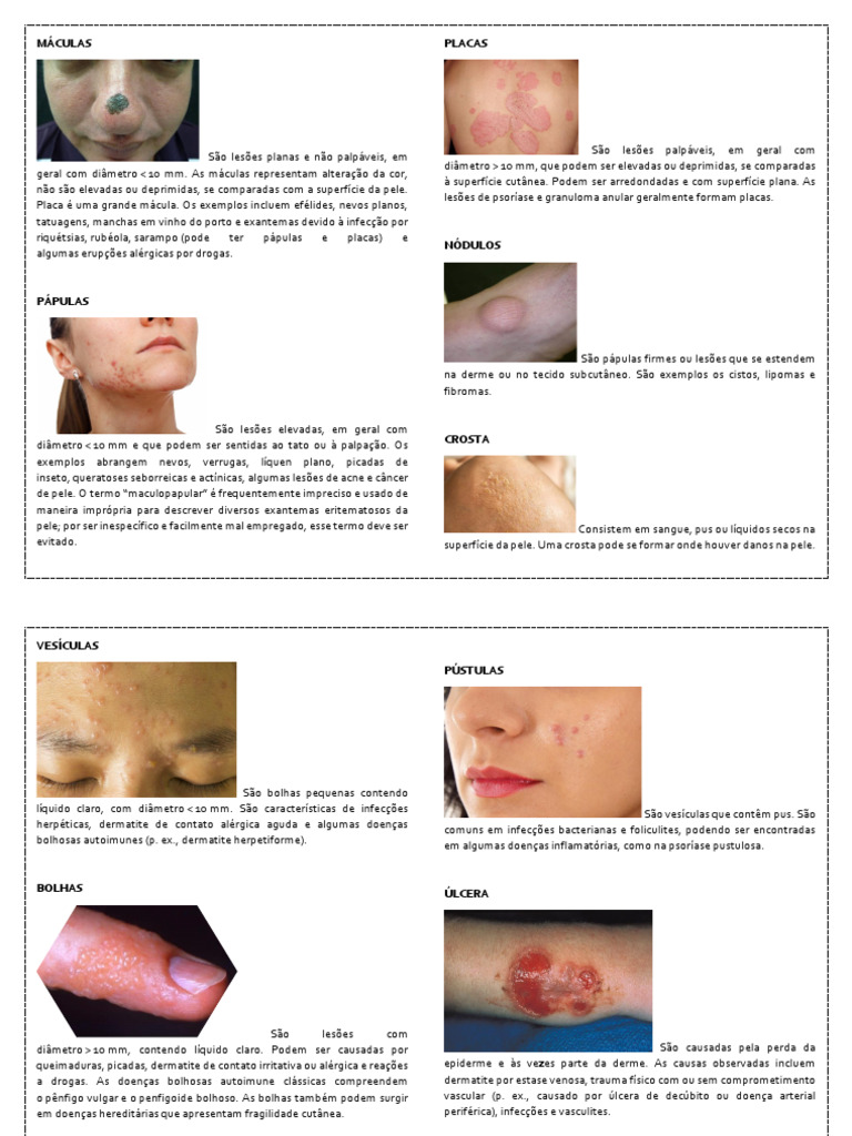 Lesões de Pele | PDF | Pele | Dermatite