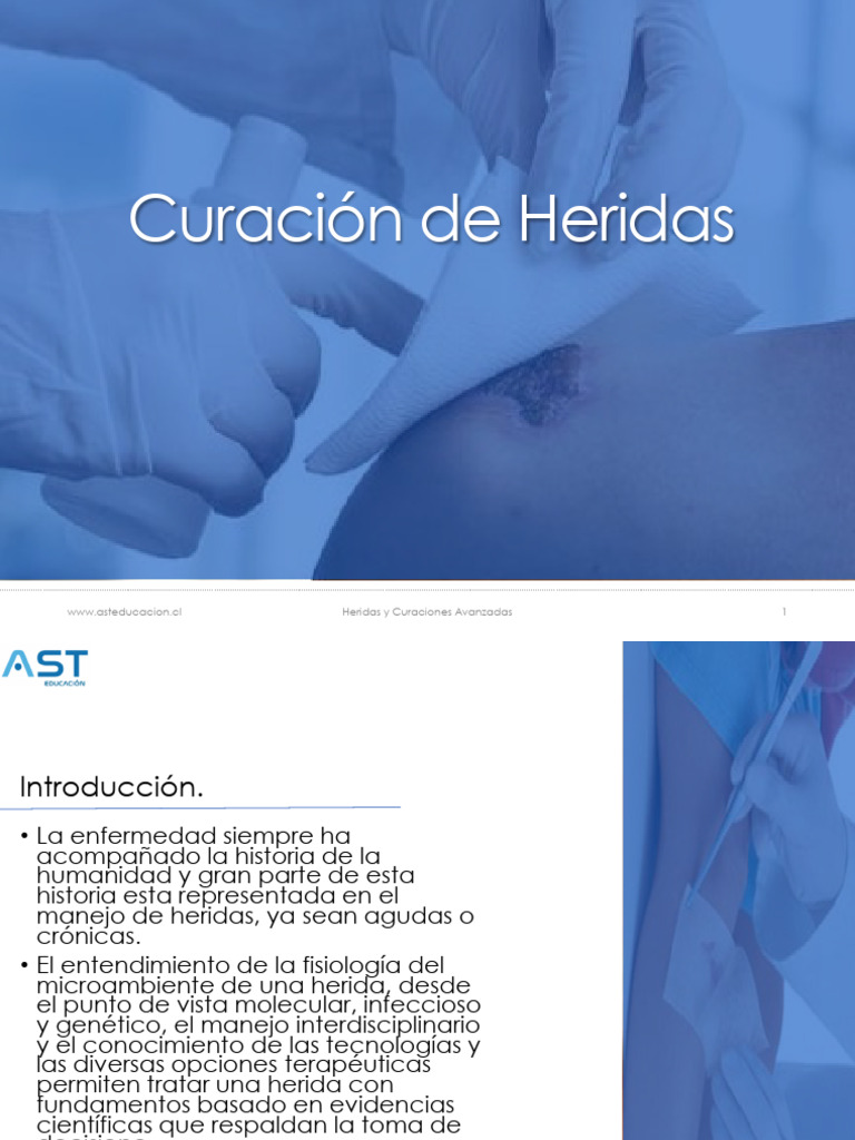 Tipos de Curaciones de Heridas | PDF | Herida | Curación