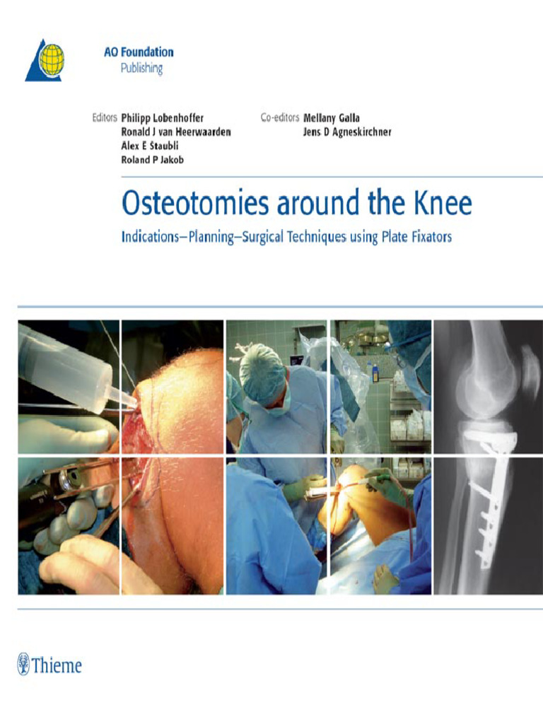 Osteotomies Around The Knee Indications-Planning-Surgical T111 | PDF ...