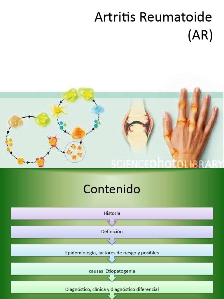 Art Ritis Reuma To Idea 2022 | PDF | Artritis Reumatoide | Ciencias de la Salud