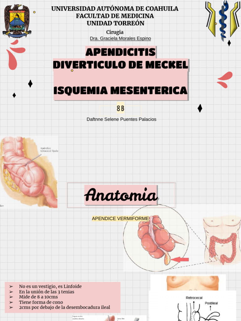 Apendicitis, Div. Meckel, IM | PDF | Isquemia | Tracto gastrointestinal