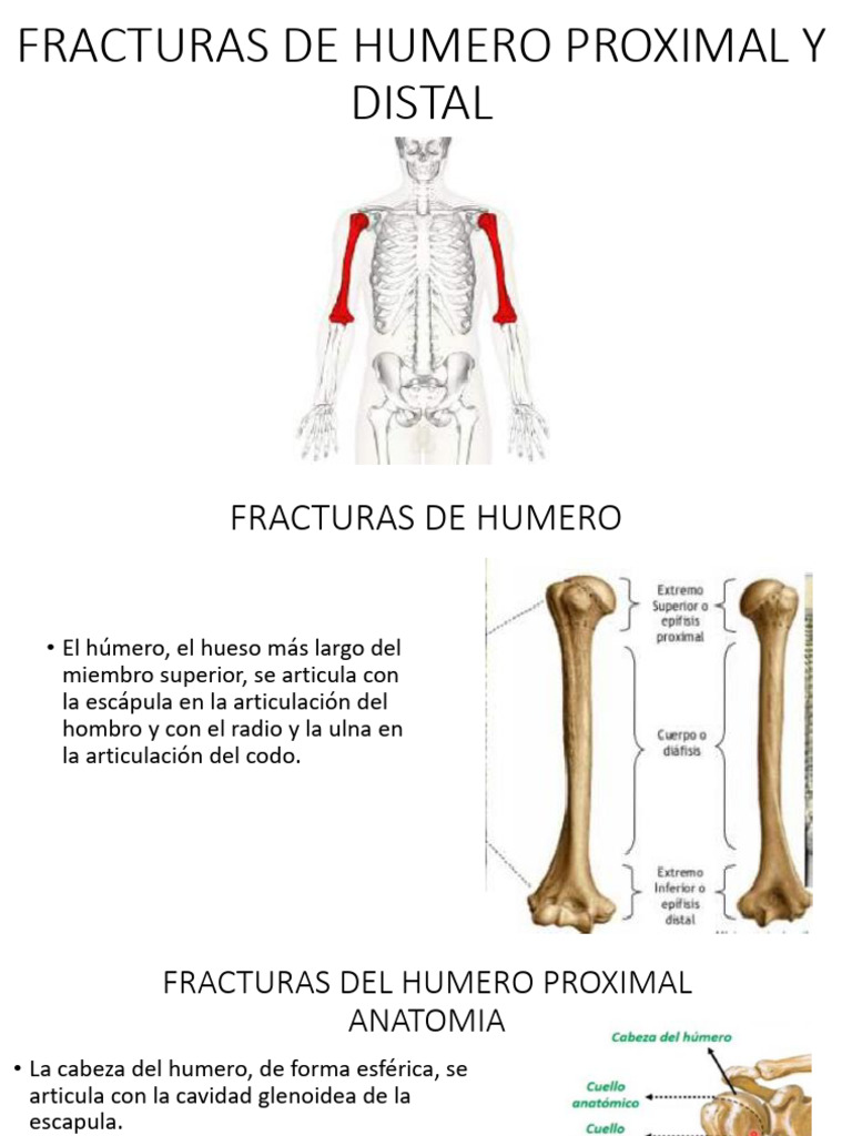 Trauma FX de Hombro, Humero, Escapula, Clavicula y Codo Expo | PDF ...