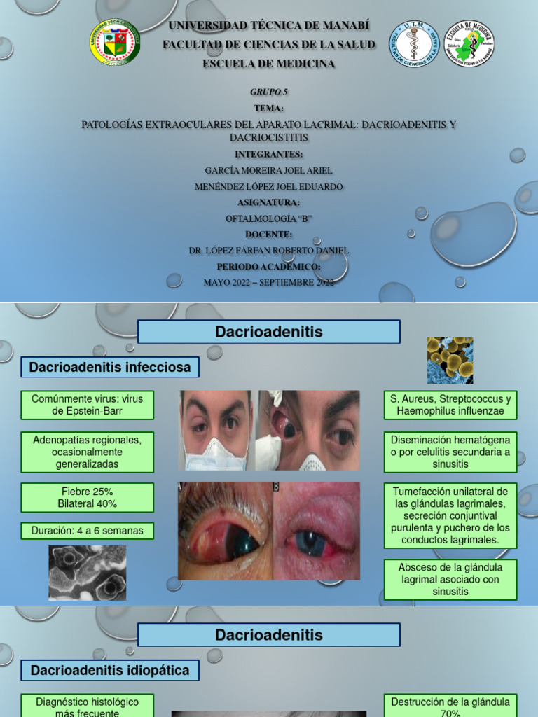 Grupo 5 Diapositivas - Dacrioadenitis y Dacriocistitis | PDF ...