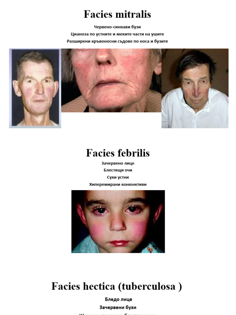 Facies | PDF
