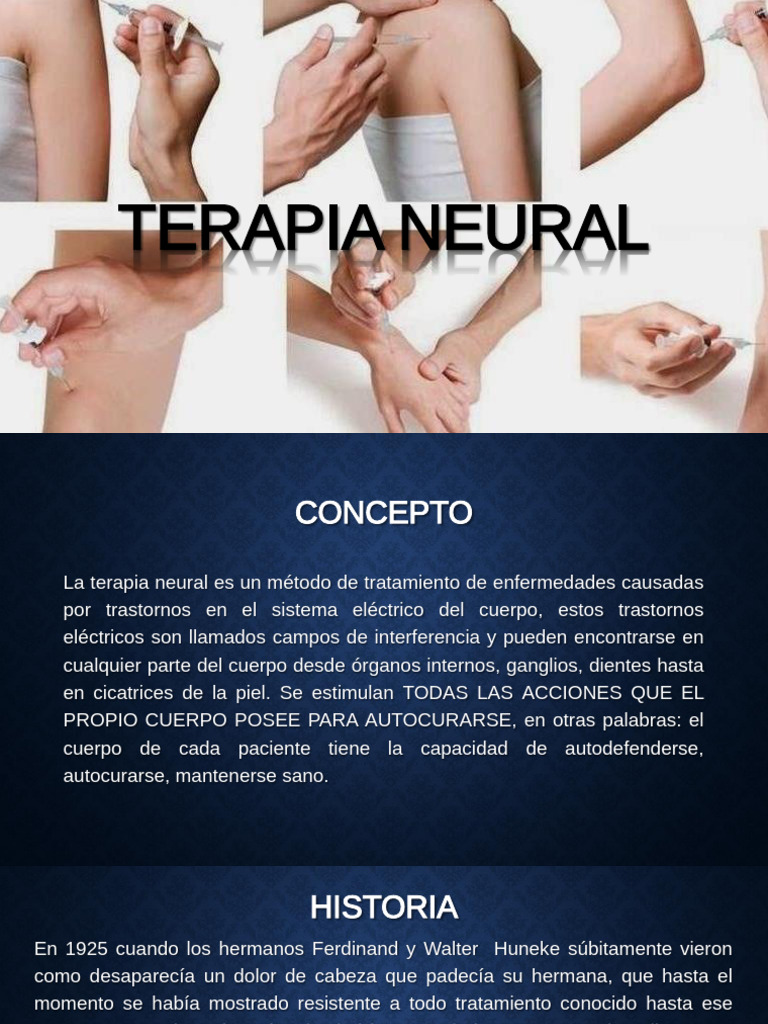Terapia Neural | Descargar gratis PDF | Tórax | Dolor