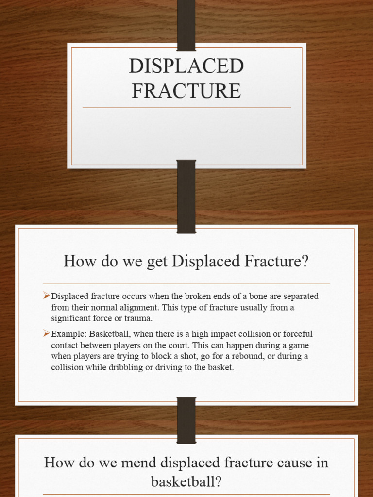 Displaced Fracture | PDF | Sports & Recreation