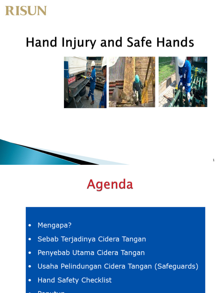 Hand Injury and Safe Hands | PDF