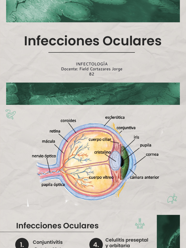 Infecciones Oculares | PDF | Córnea | Herpes Simple