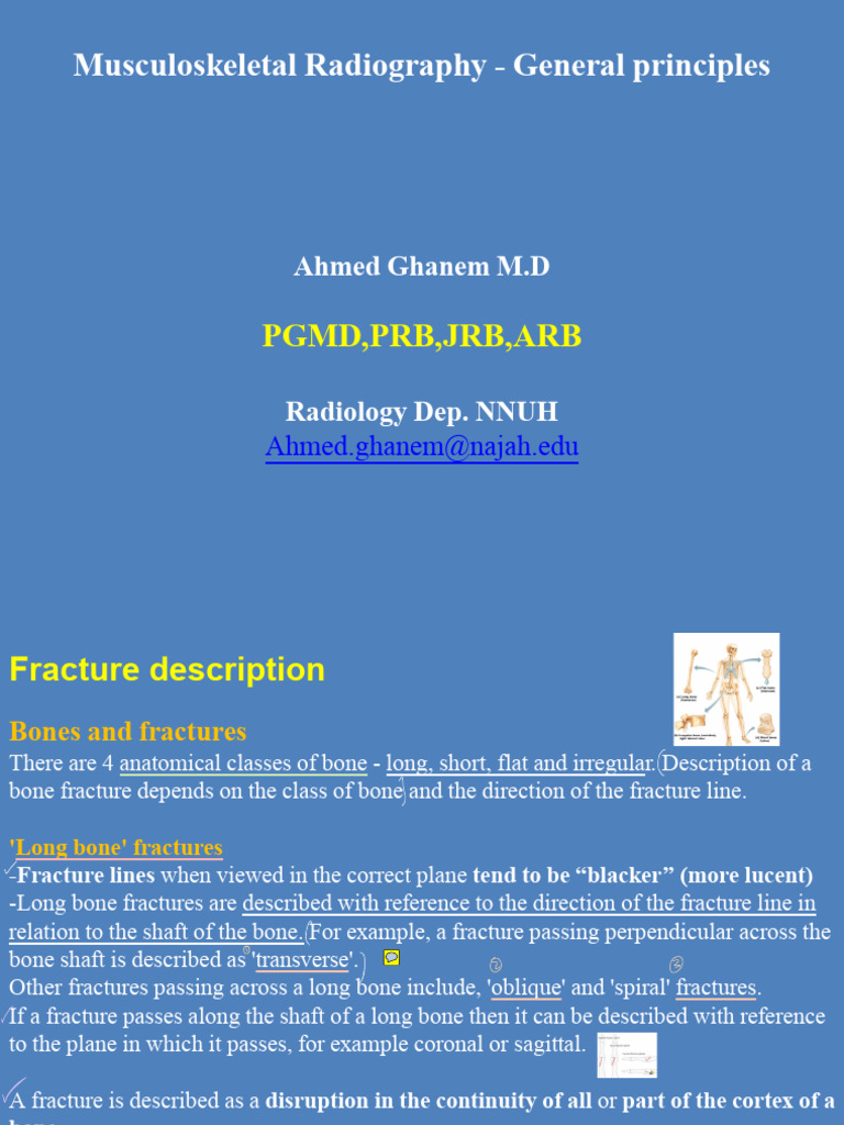 007 MSK - General Principles of Fractures. | PDF | Hip | Anatomical Terms Of Location