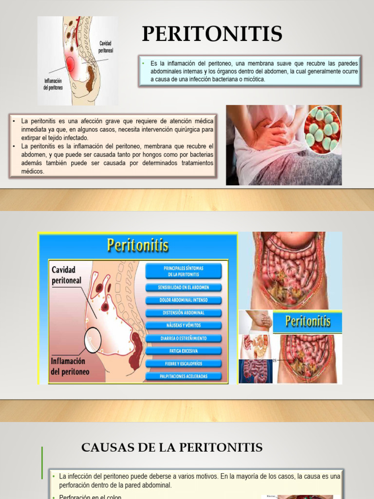 Peritonitis | PDF | Abdomen | Enfermedades y trastornos