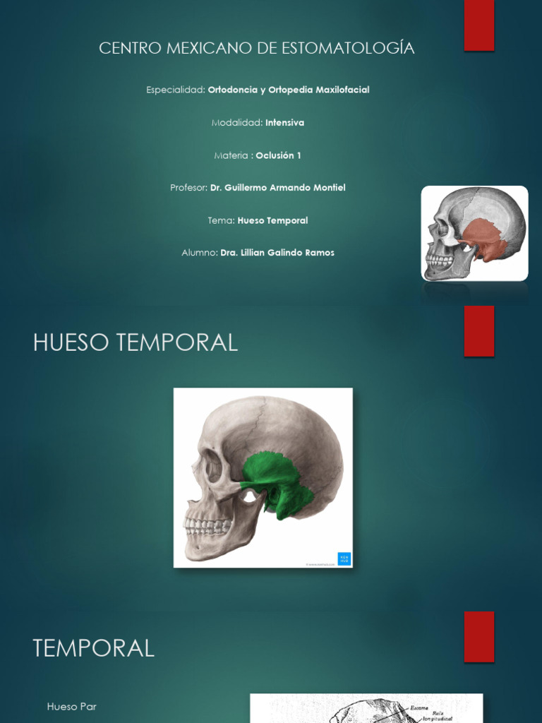 Hueso Temporal PDF | PDF | Cabeza y cuello humanos | Anatomía humana