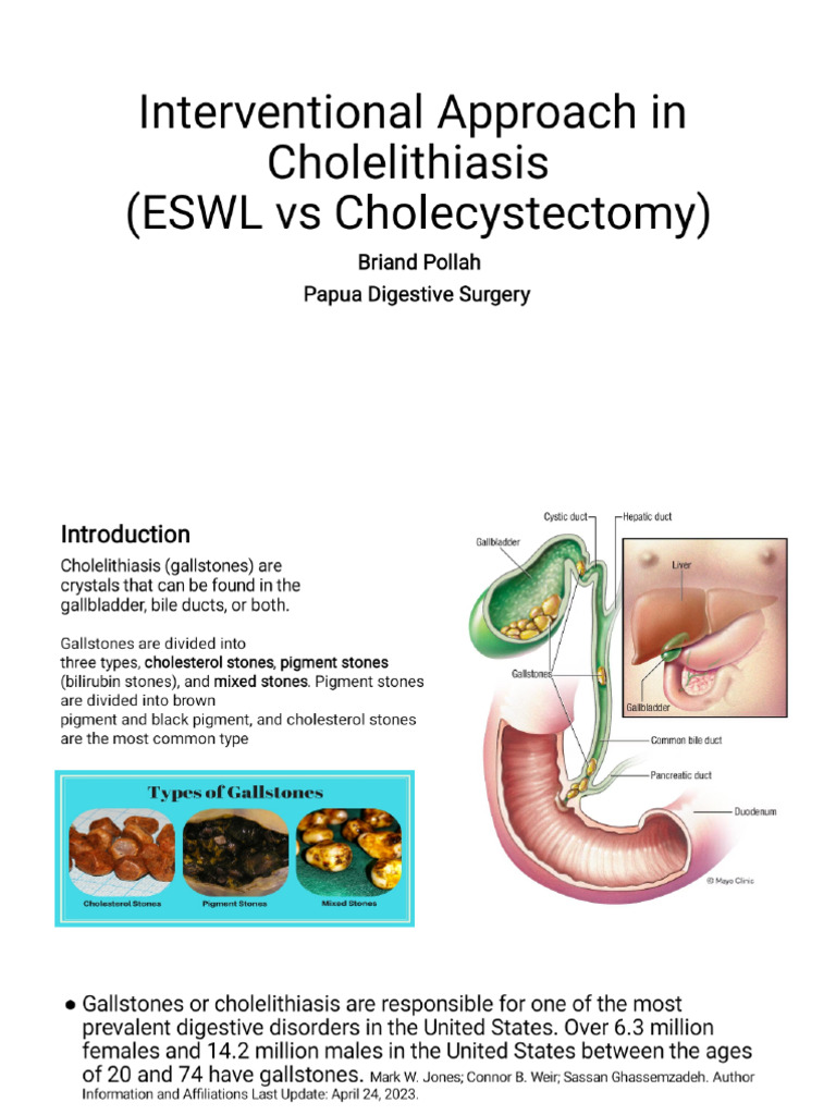 Onterventional Approach in Cholelithiasis BIP | PDF