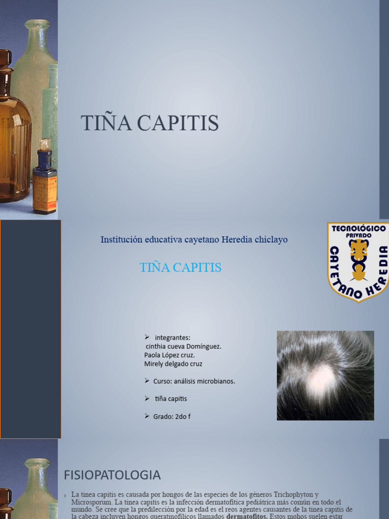 Tiña Capitis | PDF | Ciencias de la Salud | Hongo