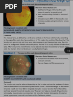 Diagnosa Icd 10LL | PDF | Glaucoma | Vision