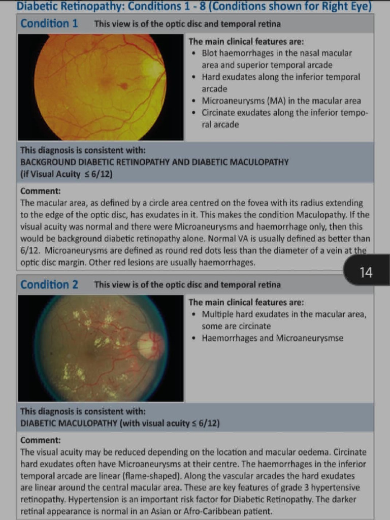 Fundoscopy Slides | PDF | Retina | Eye