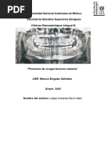 Anatomía de La Arcada Superior e Inferior de Un Paciente Edéntulo | PDF | Anatomía humana | Anatomía