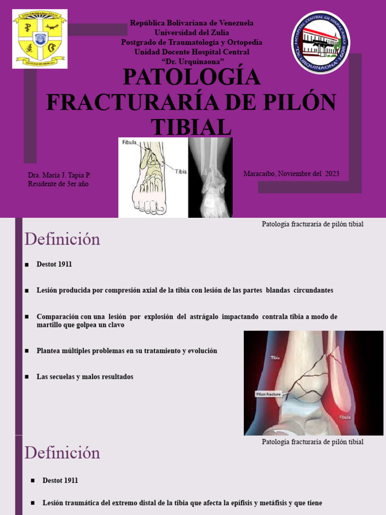 Patología Fracturaría Pilón Tibial | PDF | Tobillo | Dedo del pie