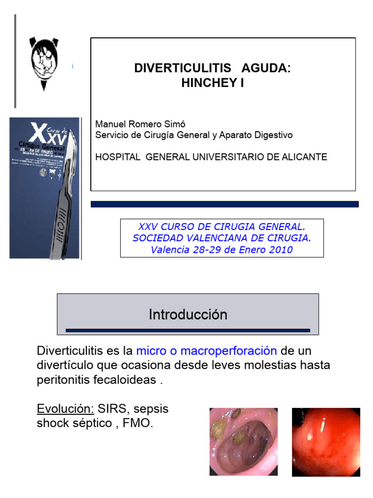Diverticulitis Aguda Tratamiento | PDF | Septicemia | Especialidades Medicas