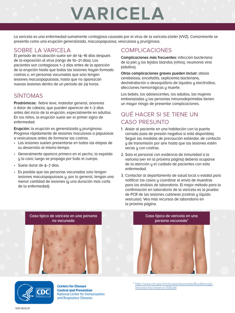 Información esencial sobre la varicela | PDF | Inmunología ...