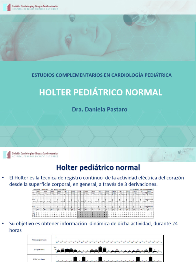 Holter Pediátrico Normal | PDF | Electrocardiografia | Sistema circulatorio