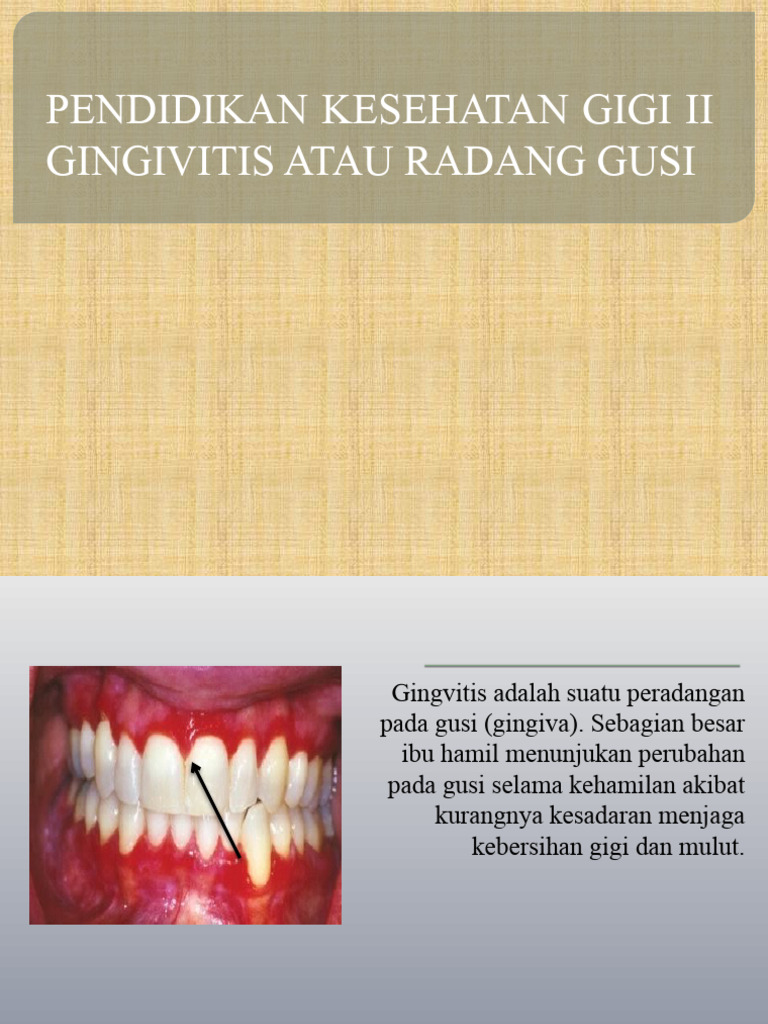 Power Point Gingivitis Atau Radang Gusi Tugas Medkom | PDF