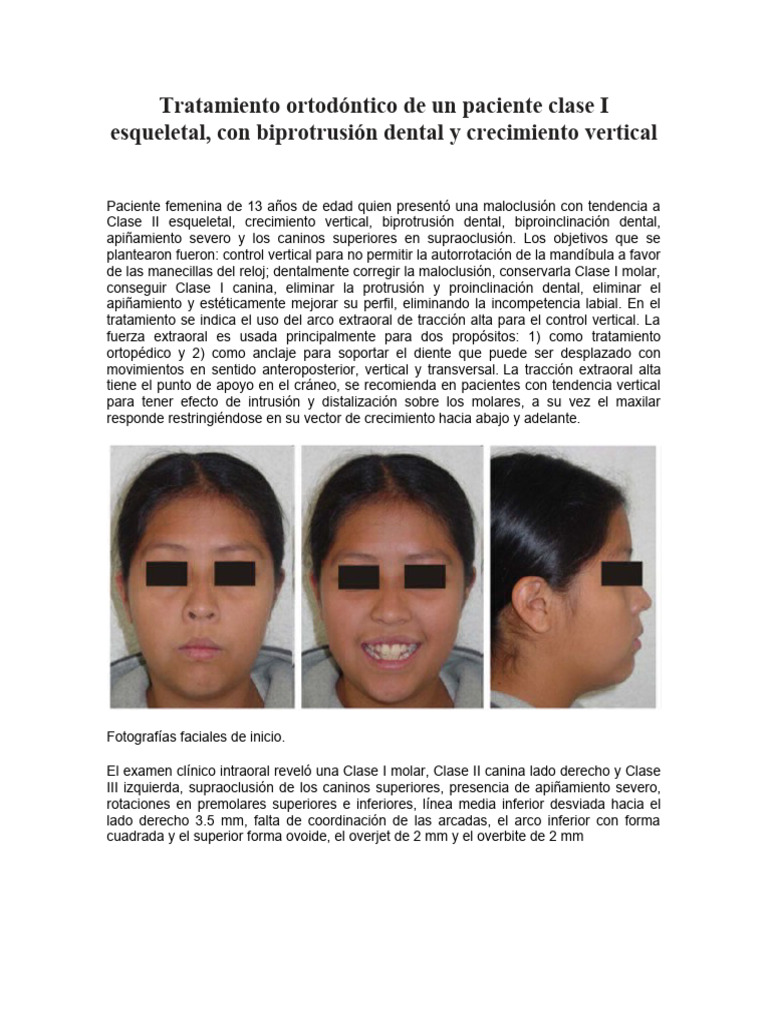Tratamiento Ortodóntico | PDF | Diente | Ortodoncia