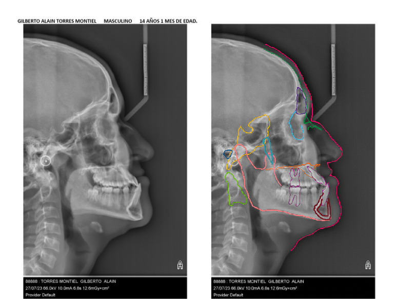 RX Lateral Alain | PDF