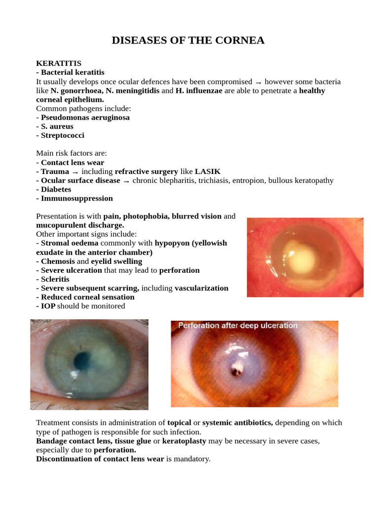Diseases of The Cornea | PDF | Cornea | Vision