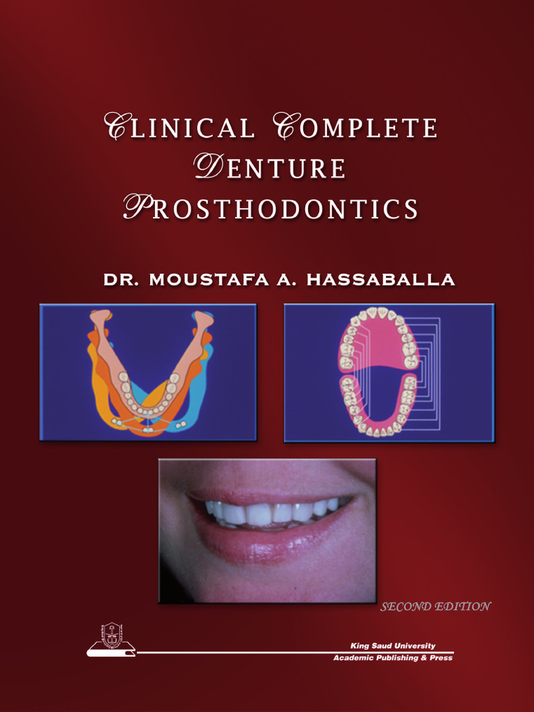 Clinical Complete Denture Prosthodontic | PDF