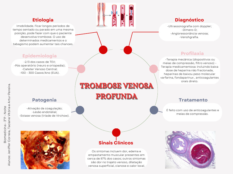 Trombose Venosa Profunda | PDF | Trombose | Medicina Clínica